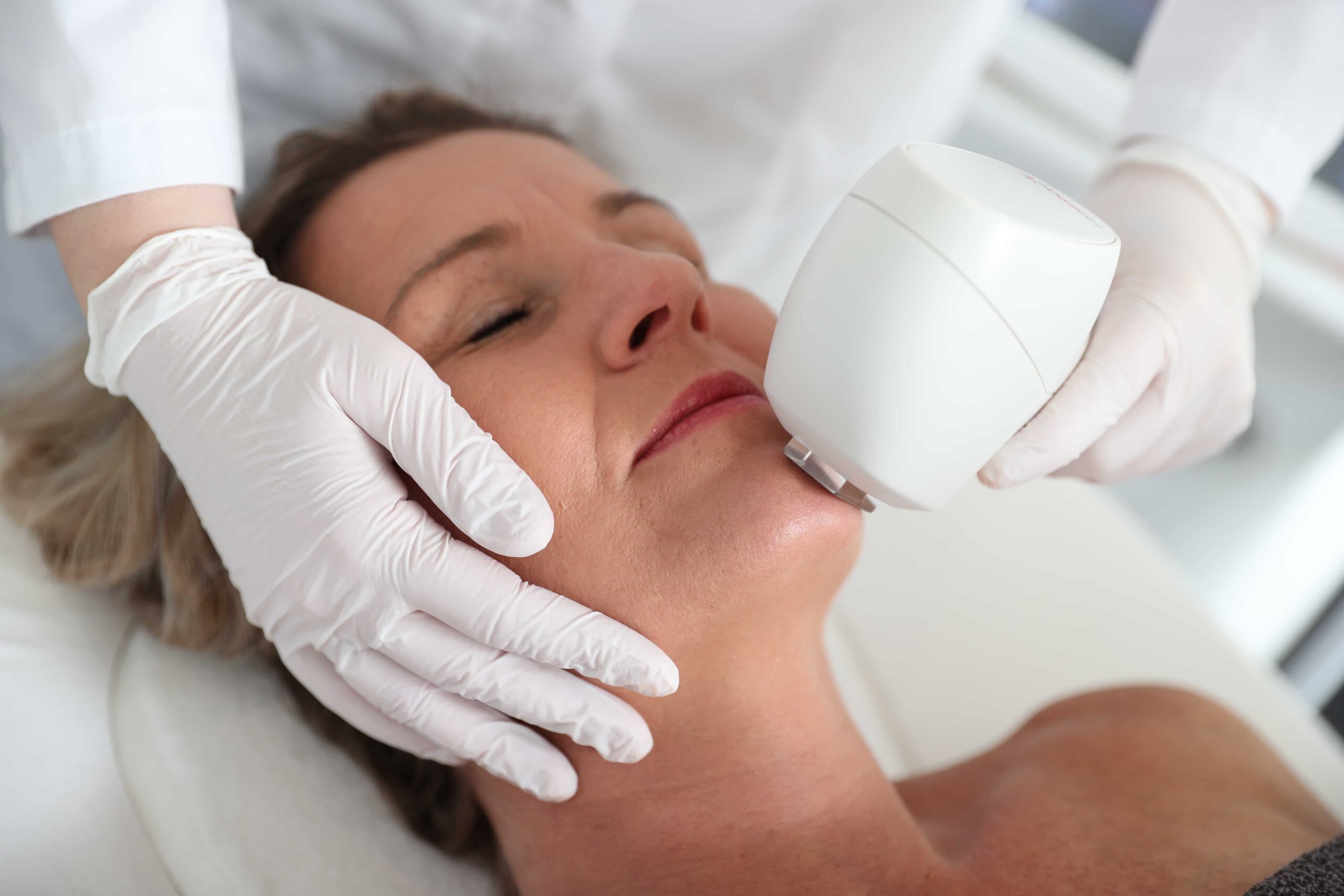 Photorejuvenation | IPL kin - Uskin the Clinic